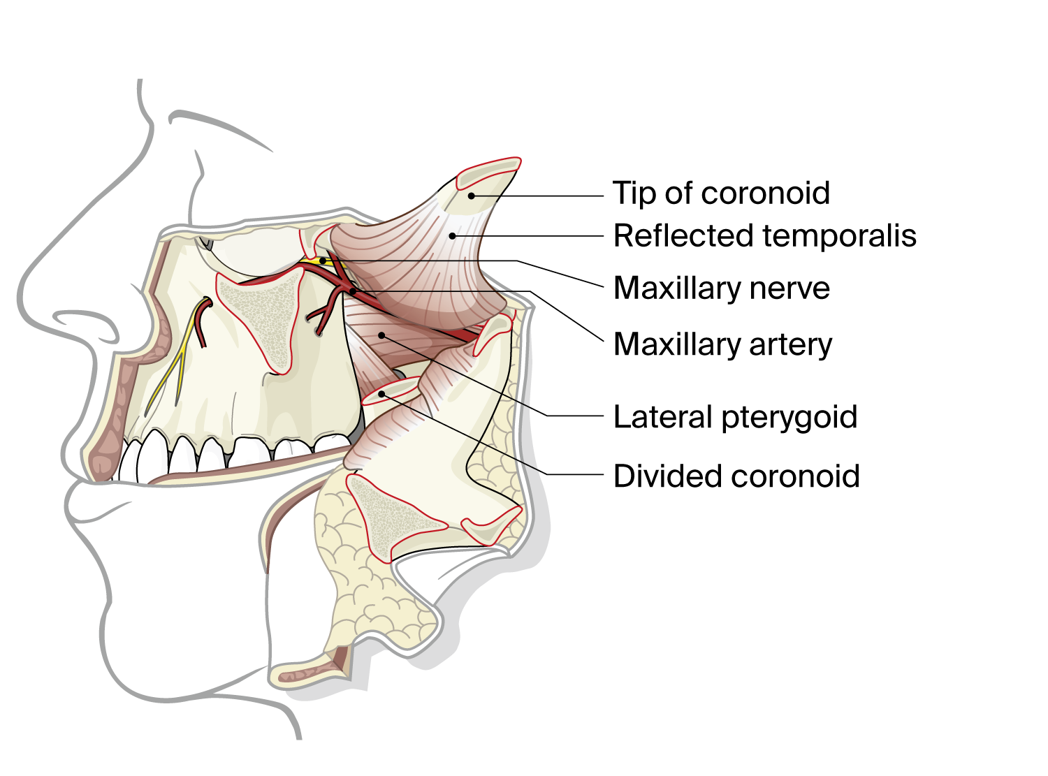 Oral cancer | Surgical Illustrations | Tamara Aepli